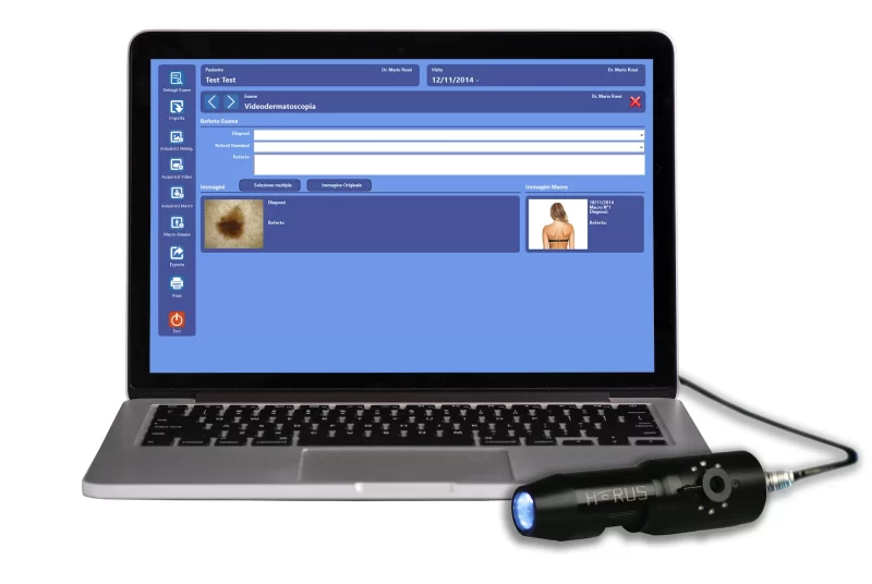 The all New Horus Basic HS 100 Skin Imaging System – Medstore