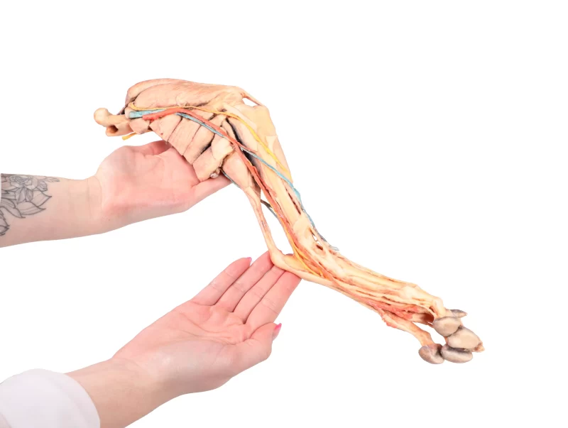 Dog hindlimb- muscles, tendons, ligaments, vessels and nerves distal to ...